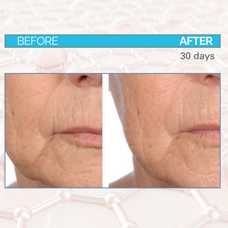 Deep Wrinkle Filler - Trace + Erase – Serious Skincare