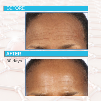 Deep Wrinkle Filler - Trace + Erase – Serious Skincare